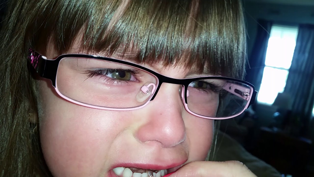 The things that get stuck in little kids mouths! - YouTube