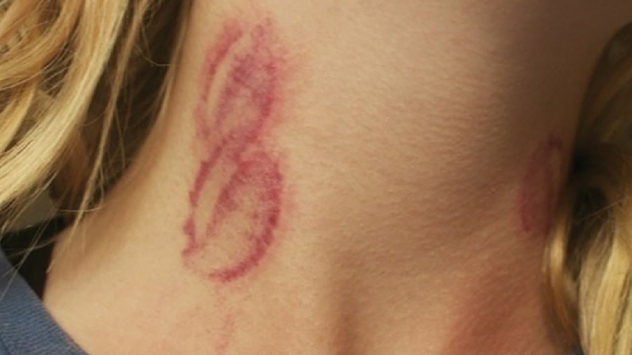 how to give yourself a hickey on your neck with your hands easy - YouTube