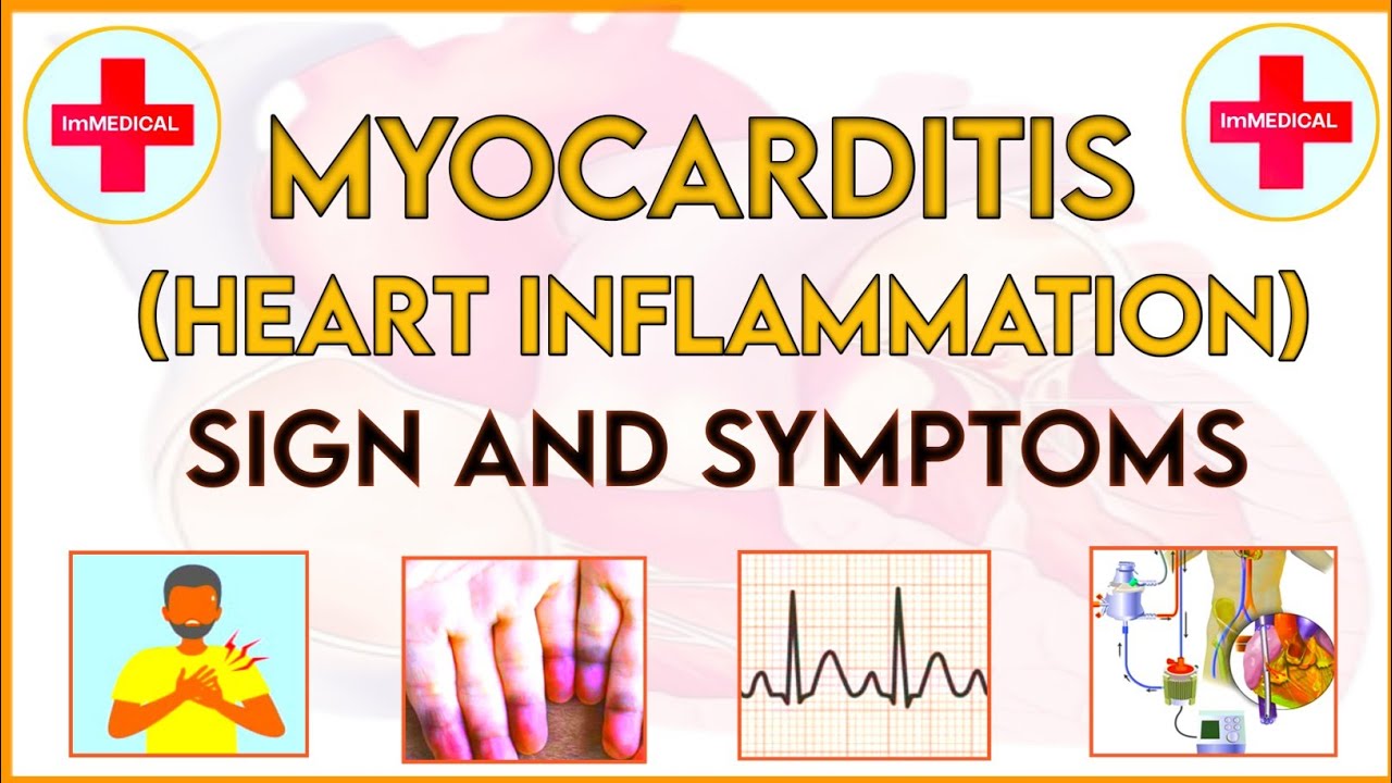 Myocarditis- causes, pathogenesis,sign and symptoms, diagnosis and ...