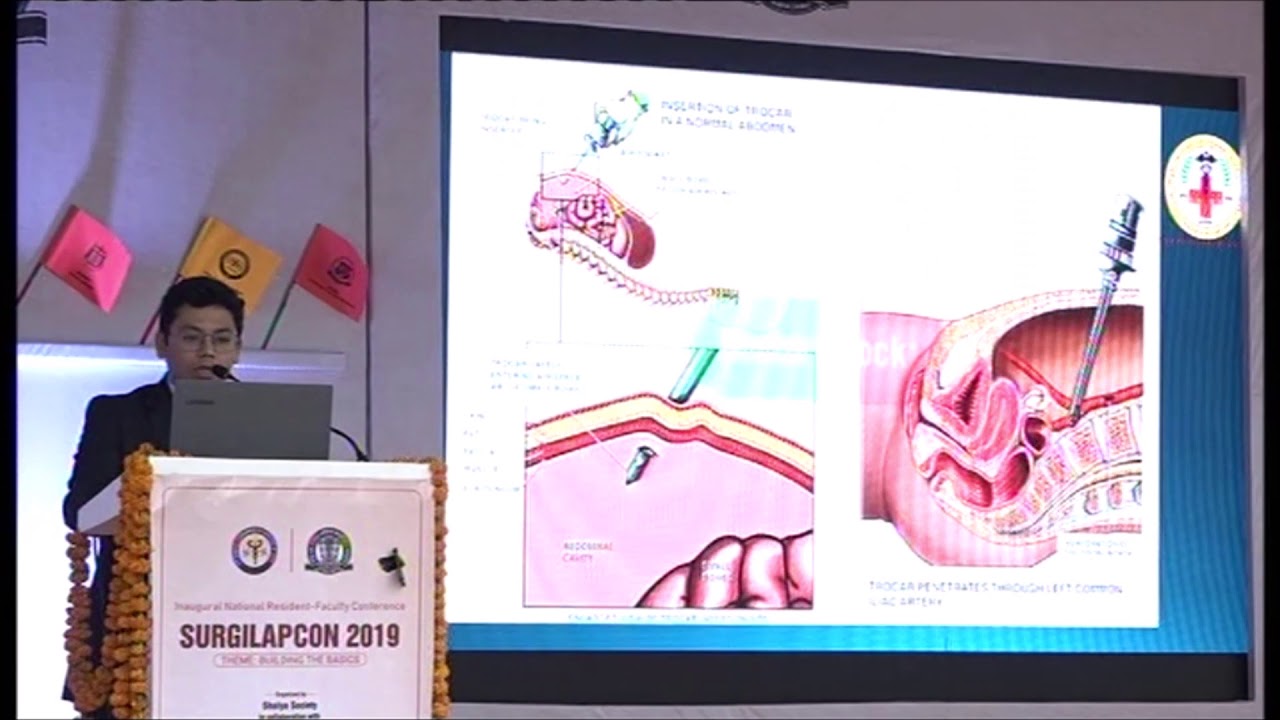 Basics Of Laparoscopic Port Insertion Surgilapcon 2019 - YouTube