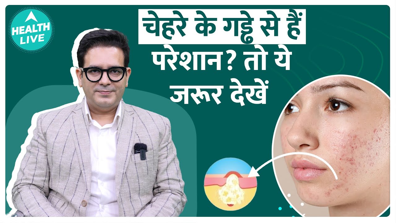 Why do pits form on face? | How can I reduce my face pits? - YouTube