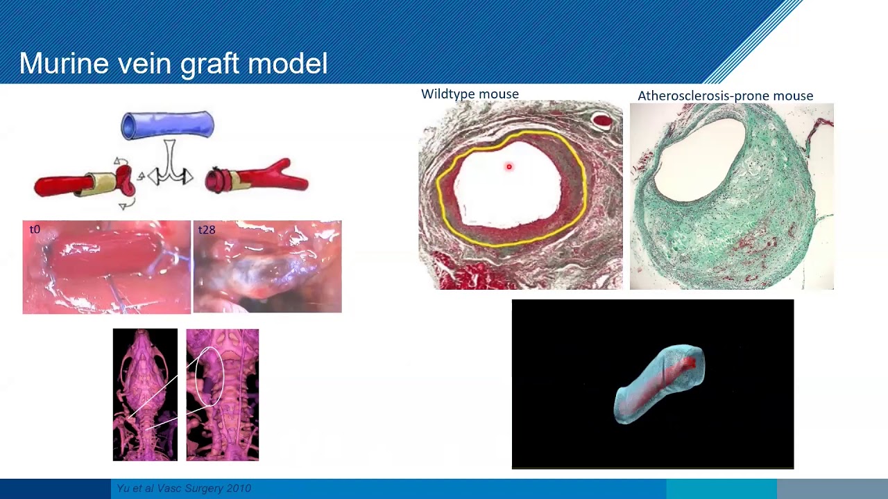 January 2021: Vascular remodeling imaging of murine vein grafts using ...