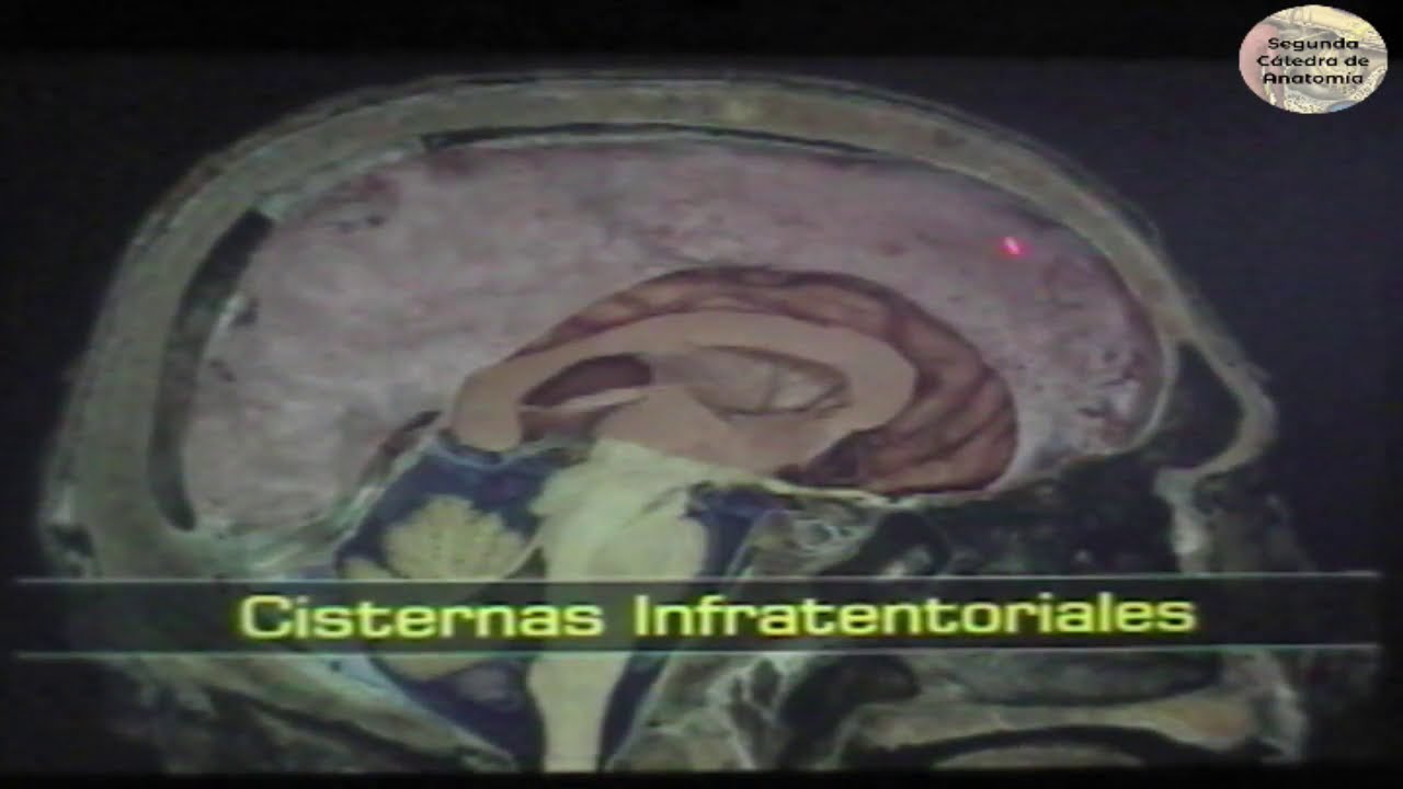 N6 | Anatomía 3D de las cisternas y su contenido | Anatomía 2 | FMed ...