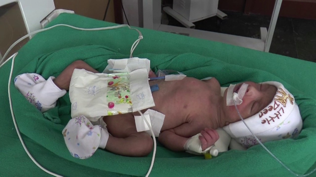 Family Centred Care for Sick Newborn- Session 2- Developmental ...