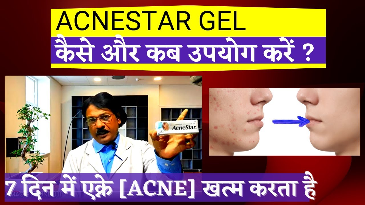 Acnestar cream-कब और कैसे लगाना चाहिए | AcneStar Gel Review |Acnestar ...