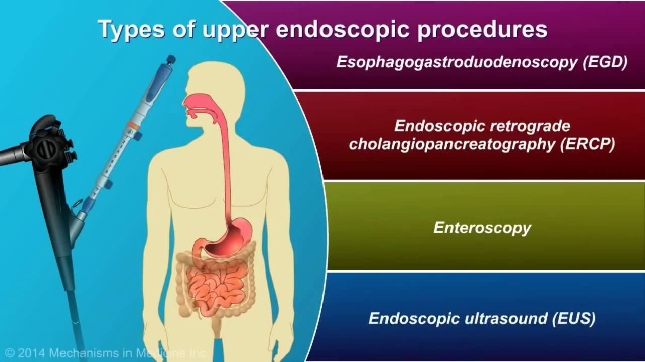 Endoscopic procedure - YouTube