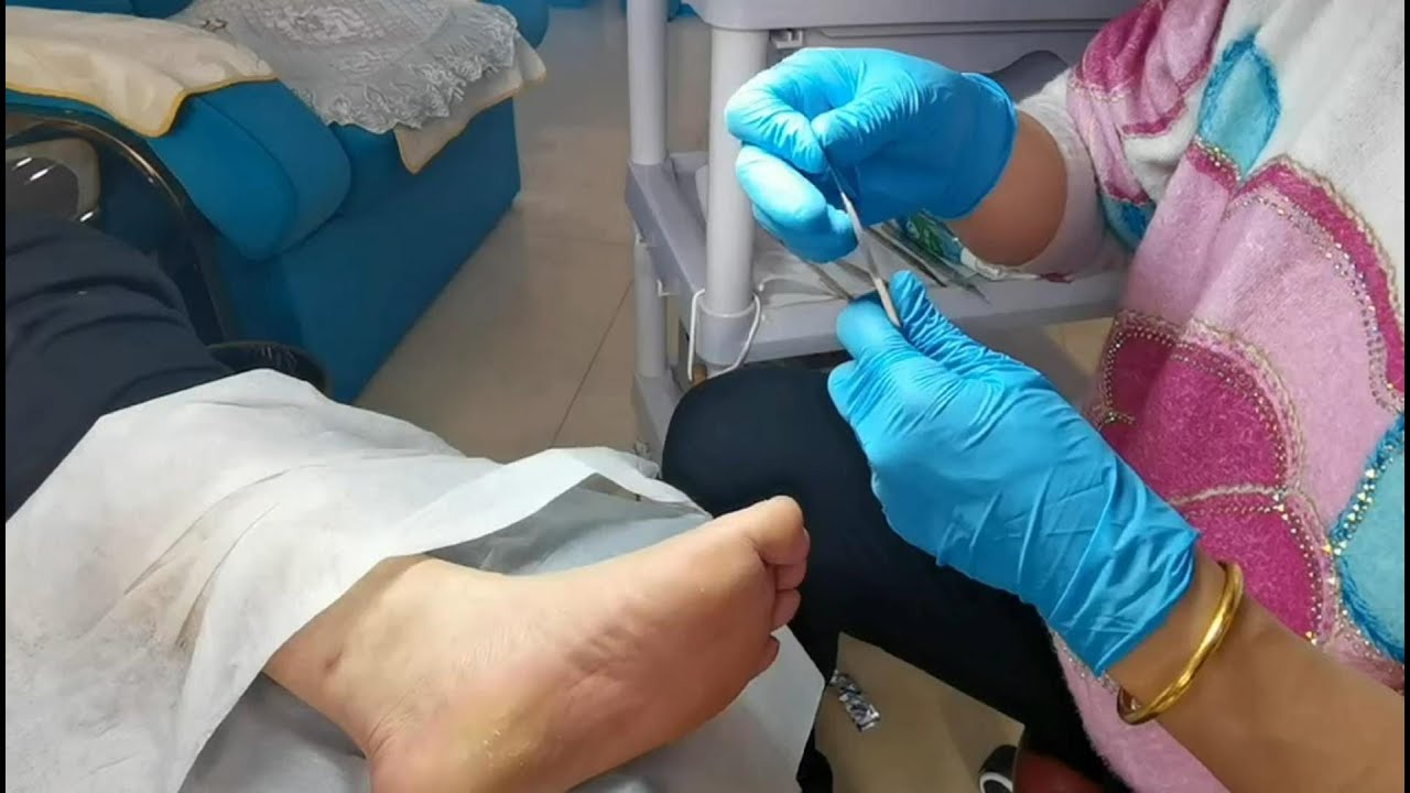Pedicure : Foot care, fantastic process here is. Dead skin removal ...