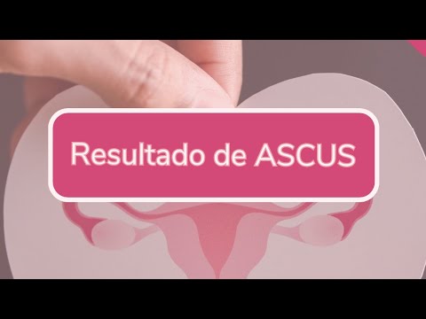 Resultado de ASCUS y colposcopia normal - YouTube