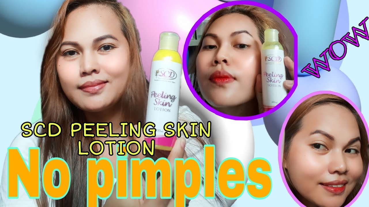 SCD PEELING SKIN LOTION REVIEW || MY SKINCARE || JUST LOTION - YouTube