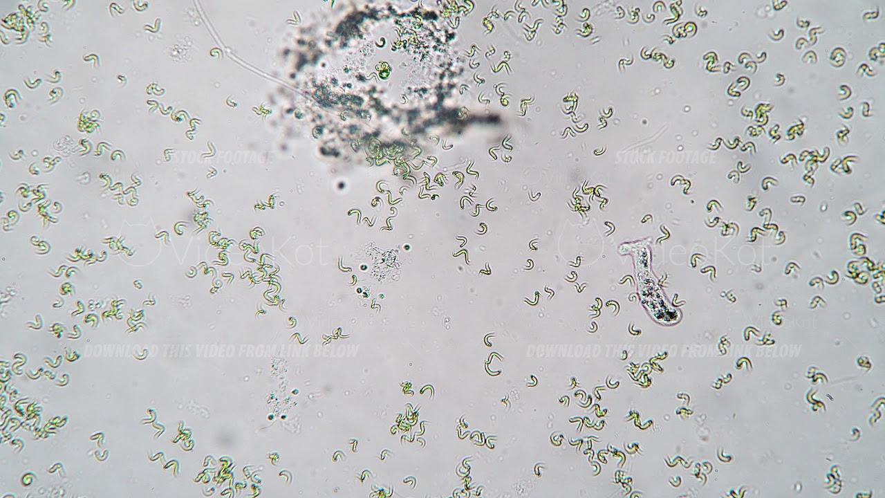 The amoeba moves fast in a drop of water timelapse - YouTube