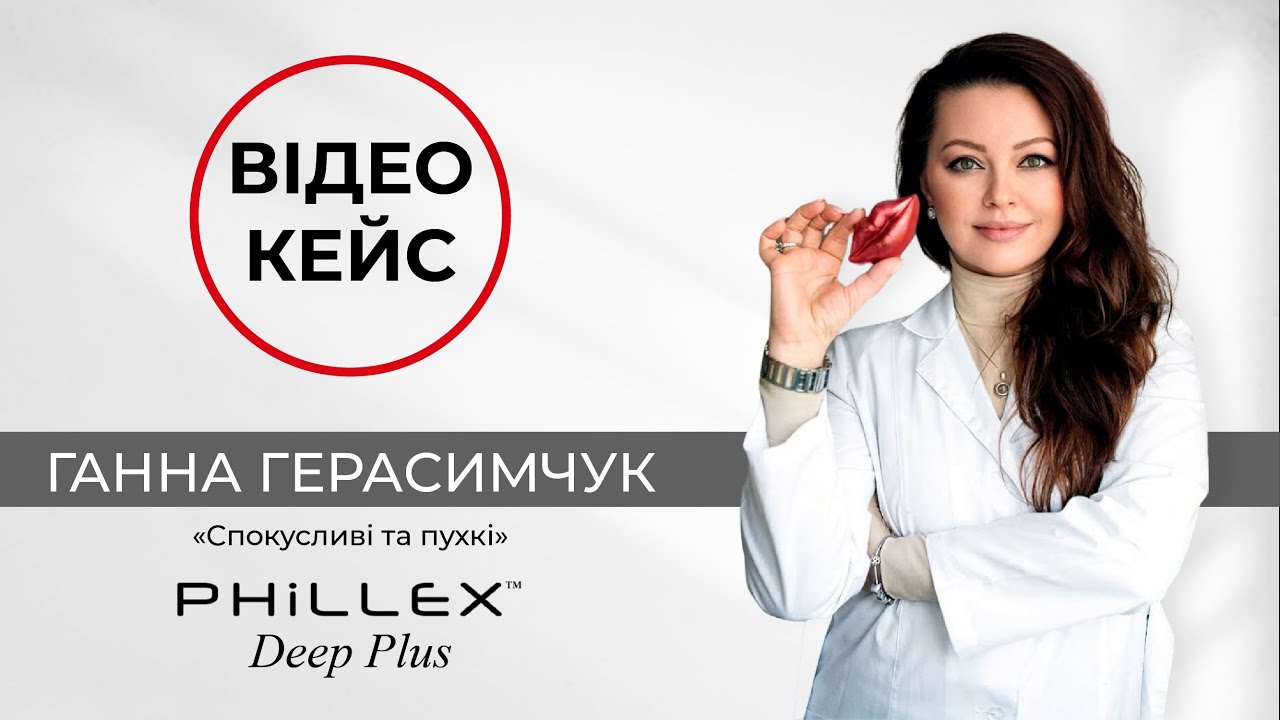 Ганна Герасимчук - Корекція губ препаратом Phillex Deep Plus - YouTube