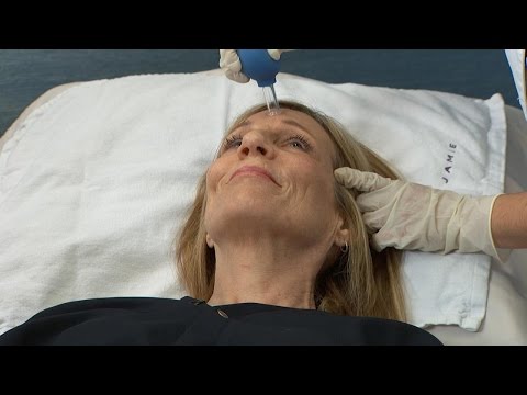 Facial Cupping for Youthful Skin?