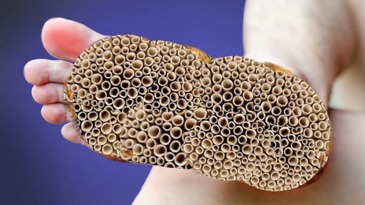 ASMR Animation Treatment | Remove Maggots & Worm Infected Foot ...