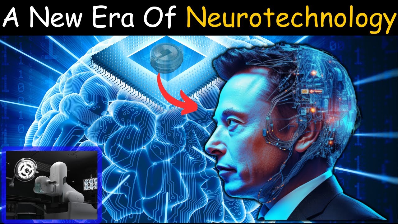 "Neuralink's First Human Brain Chip Implant: A New Era of ...