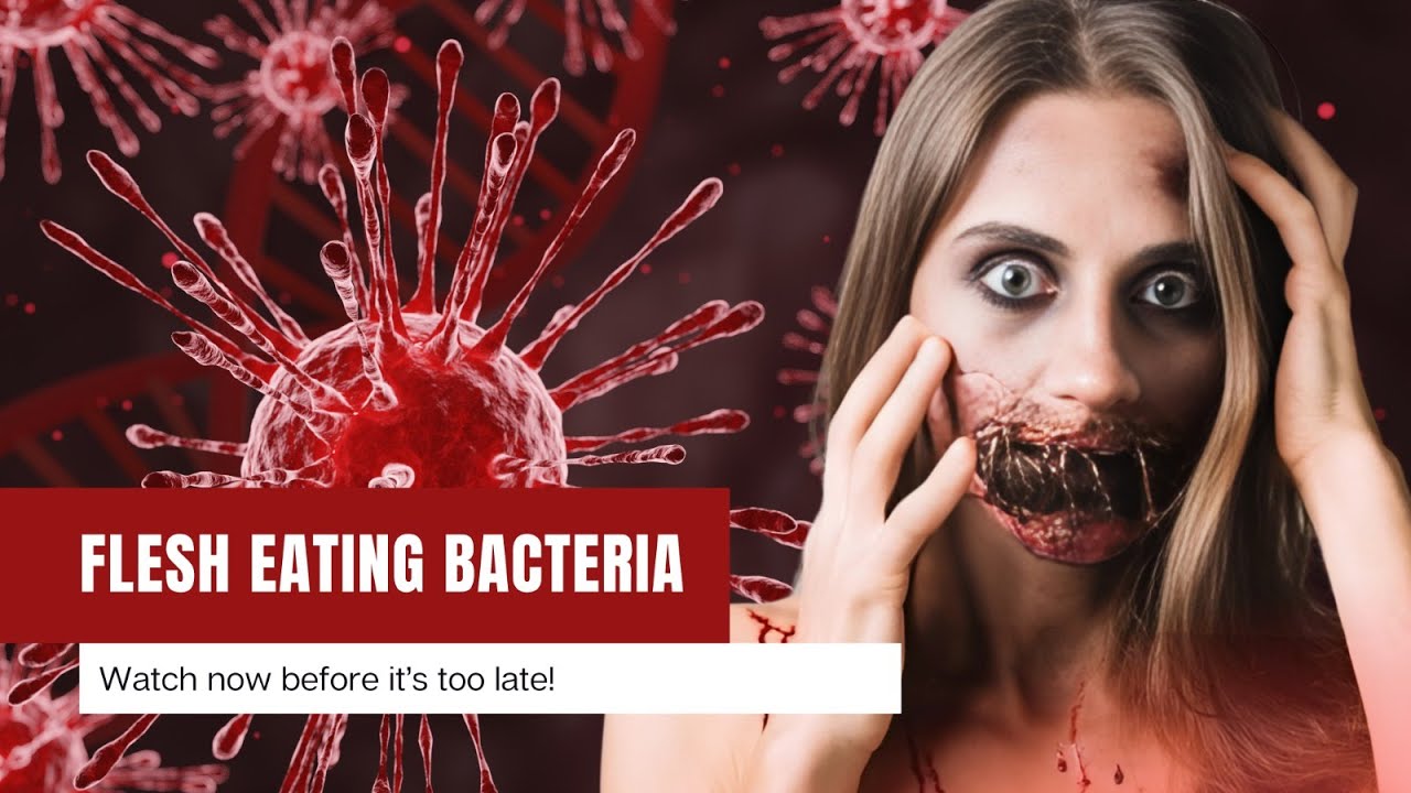 Flesh-Eating Bacteria: The Scary Truth You Need to Know! - YouTube