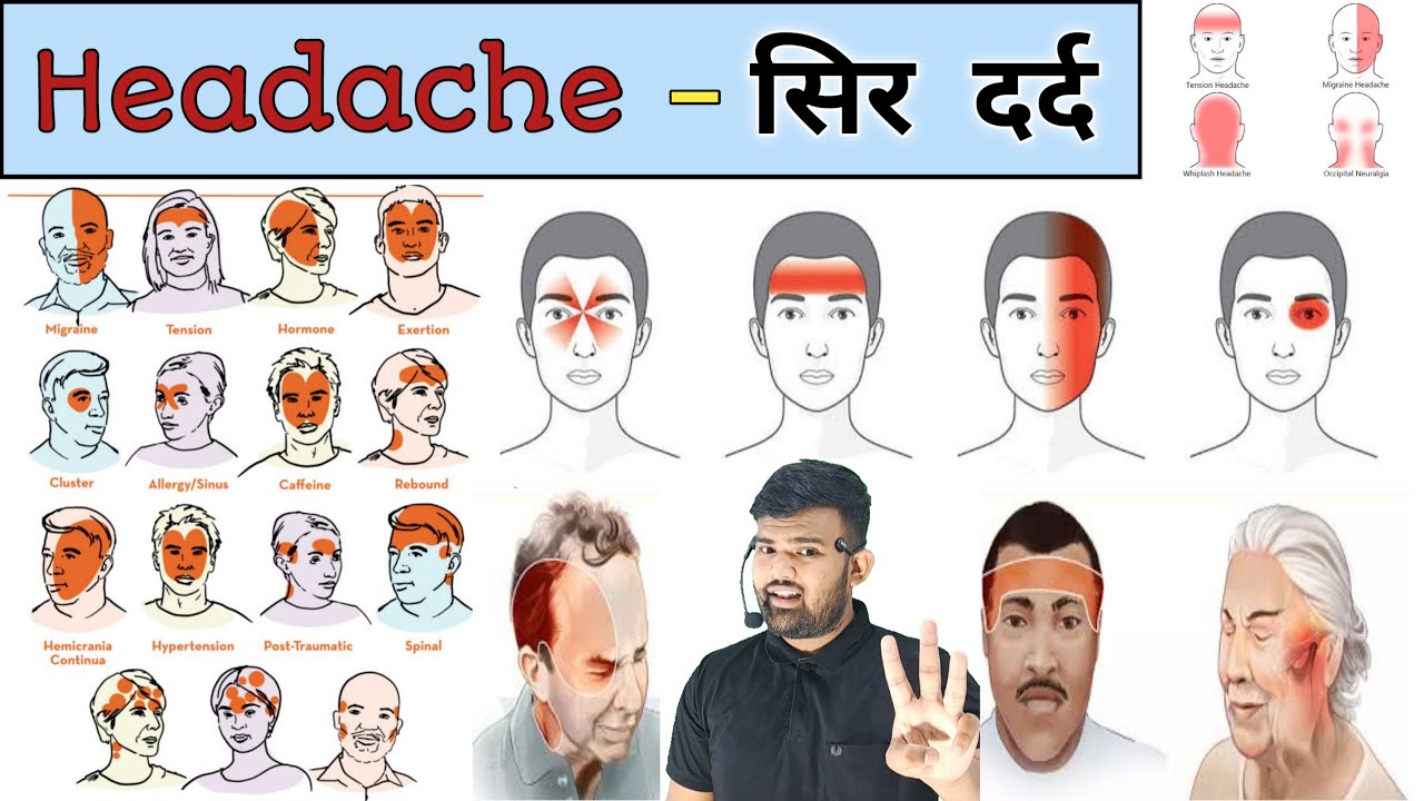 Headache | सिर दर्द | Medicine | Treatment | Injection | Tablet ...