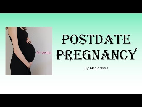 [O&G] Postdate pregnancy/ late childbirth - definition, cause, harm ...