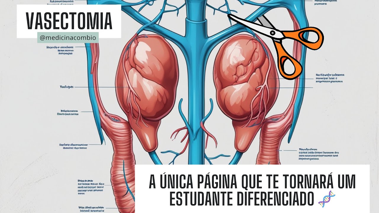Como funciona a vasectomia? - YouTube