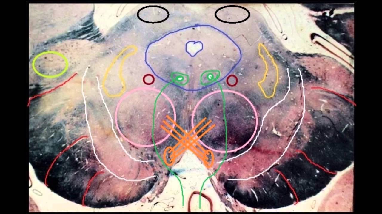 Corte de mesencefalo a nivel de coliculos superiores - YouTube