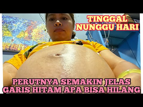 HAMIL BERJALAN 9 BULAN SEMAKIN BESAR GARIS HITAM KOK MALAH JELAS APA BISA HILANG NANTI
