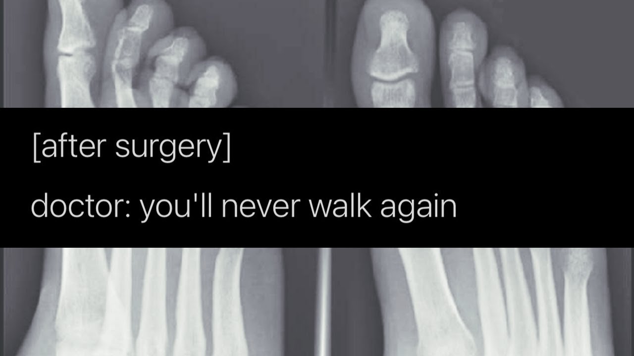 You'll never walk again - YouTube
