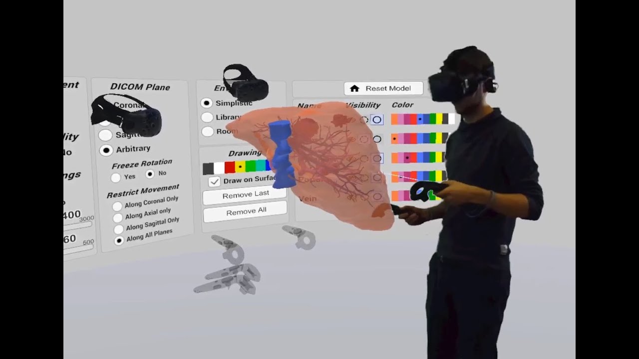 VR Multi User Liver Exploration for Treatment Planning - YouTube
