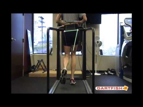 Runner's Hip Drop: Running Lab Excessive Hip Adduction posterior view ...