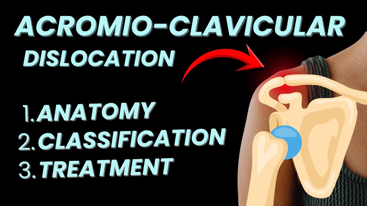 Acromioclavicular Joint Dislocation: Anatomy, Classification, Treatment ...