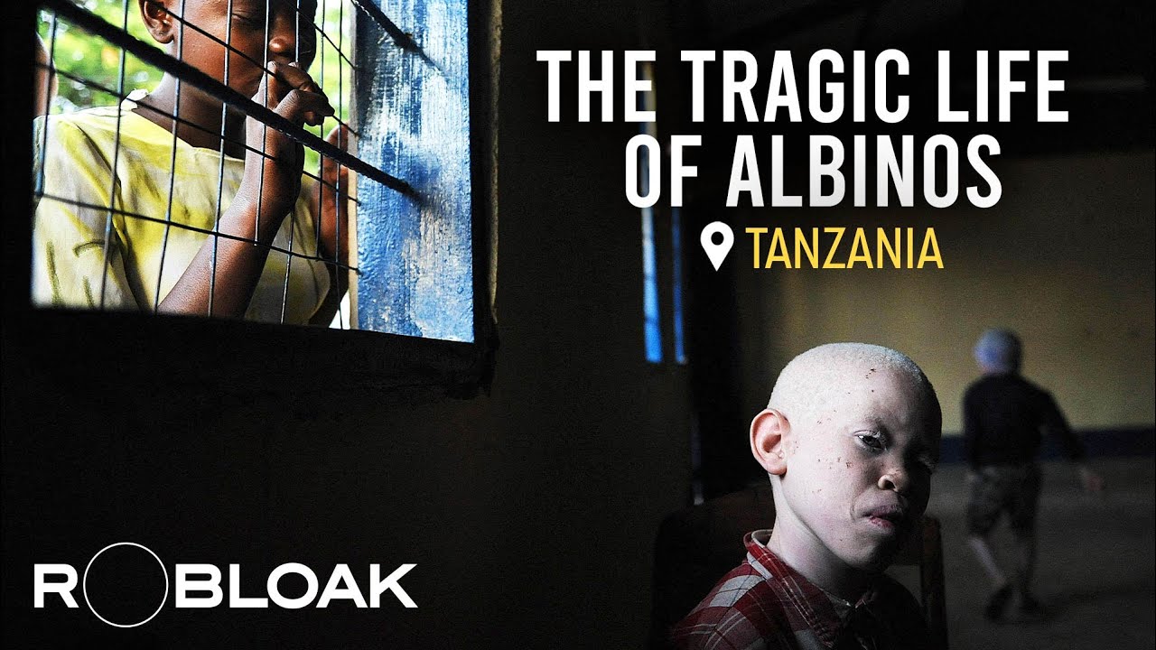 Tragic Life of Albinos: The Dark Side of Magical Beliefs - YouTube
