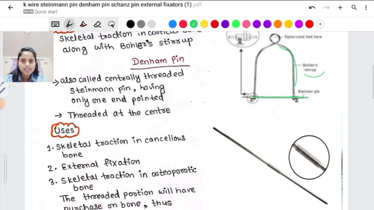 K wire | Steinmann pin | Denham pin | Schanz pin | External fixators ...