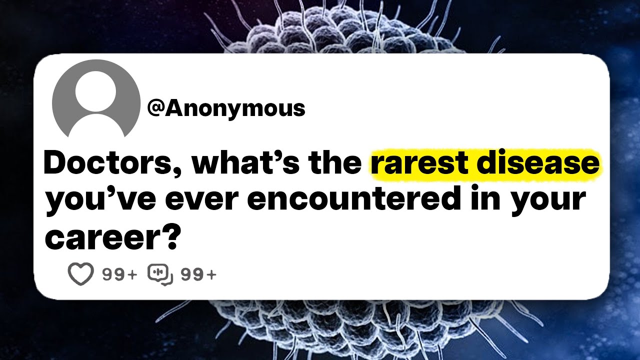 Doctors, what's the rarest disease you've ever encountered in your ...