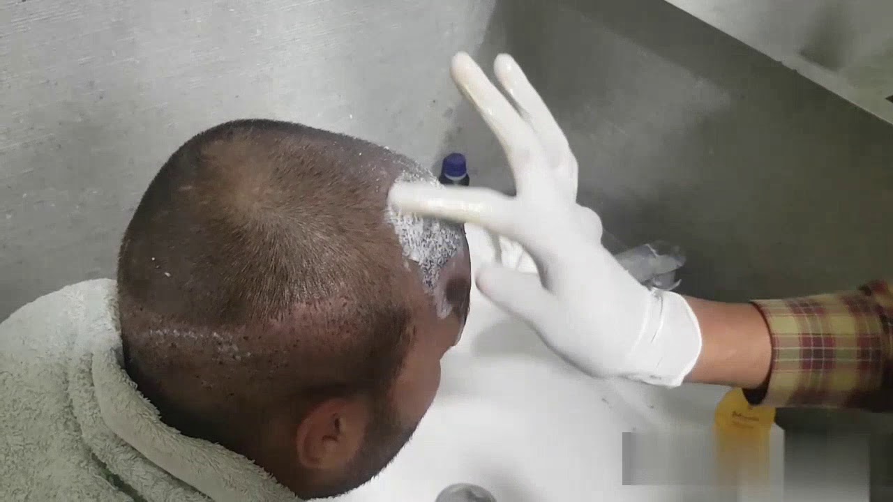 Full head wash after 7 days - YouTube