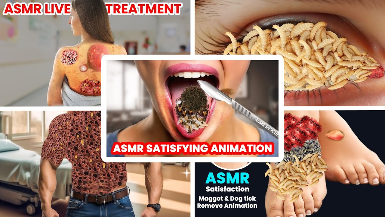 Live ASMR Animation Maggot and Dog Ticks Removal Collection | #asmr # ...