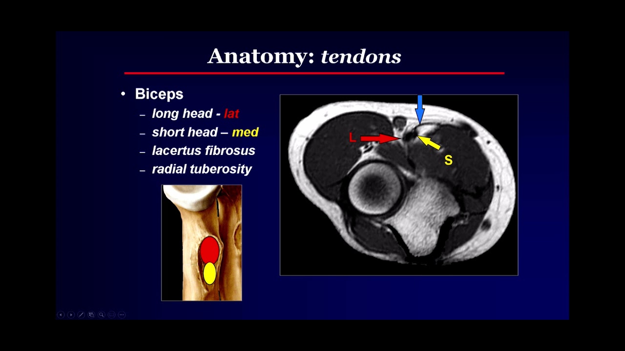 MRI Elbow lecture - YouTube