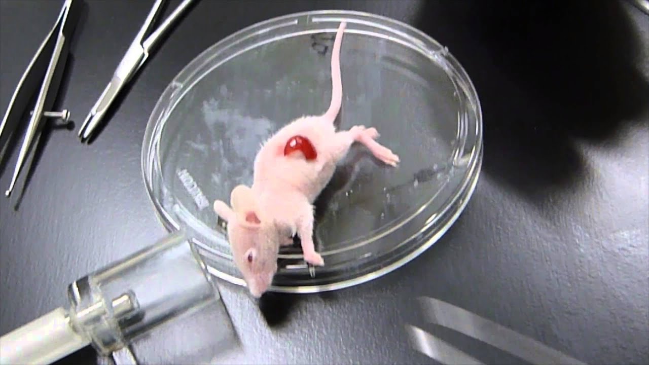 HAES injection into the spleen - YouTube