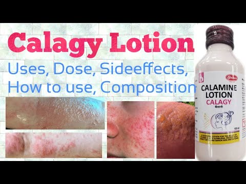 Itching,minor skin irritations,acne,sunburn, poison ivy | Calagy Lotion ...