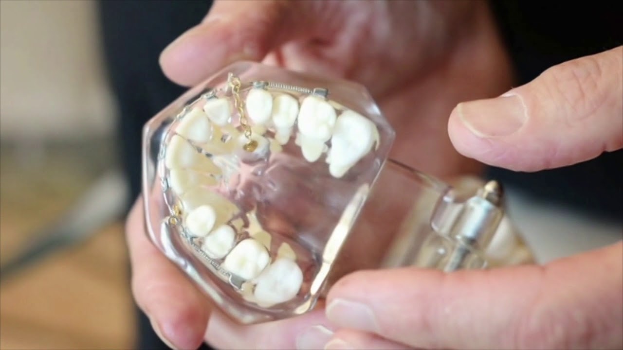 Goodman Torquing Spring (GTS) - YouTube