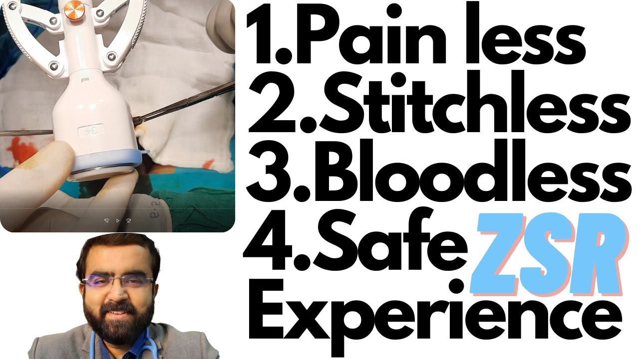 ZSR Stitchless Circumcision,Frenuloplasty What YOU need to know? Dr ...