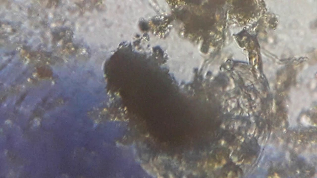 Observation microscopique - Tardigrade -2- - YouTube