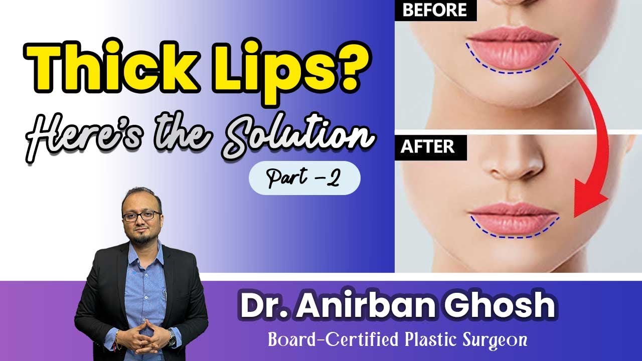 Permanent Solution for Thick Lips | Lip Reduction Surgery - YouTube