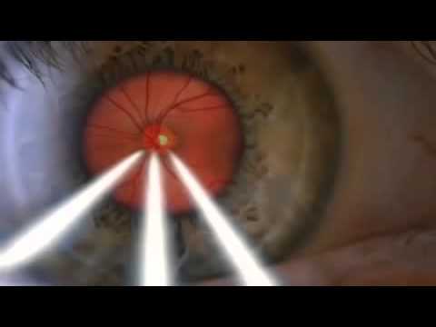 İki Dakikada Bilim fotograflarda neden göz bebekleri kırmızı çıkar