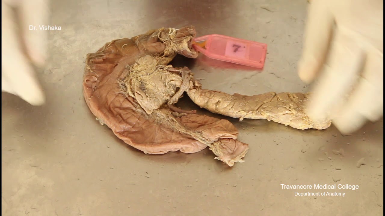 Small Intestine: Duodenum Pig (The Swine Model Advantage) - Studyguides ...