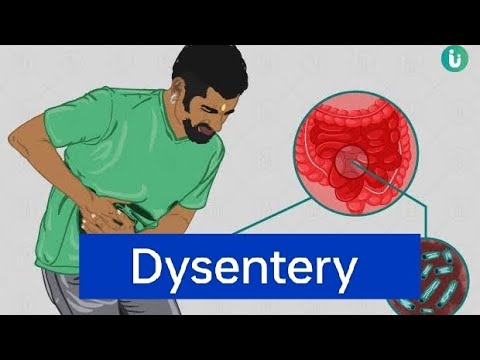 Dysentery II What is Dysentery II How the Dysentery is occur II Types ...
