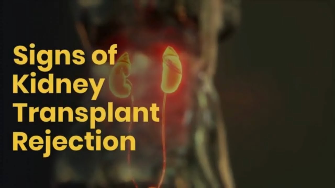 Signs of Kidney Transplant Rejection | Lyfboat - YouTube