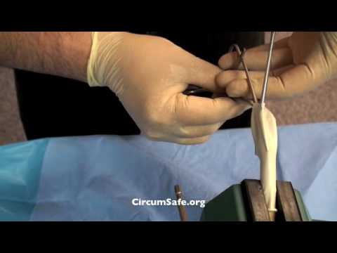 The CircumSafe Method - YouTube