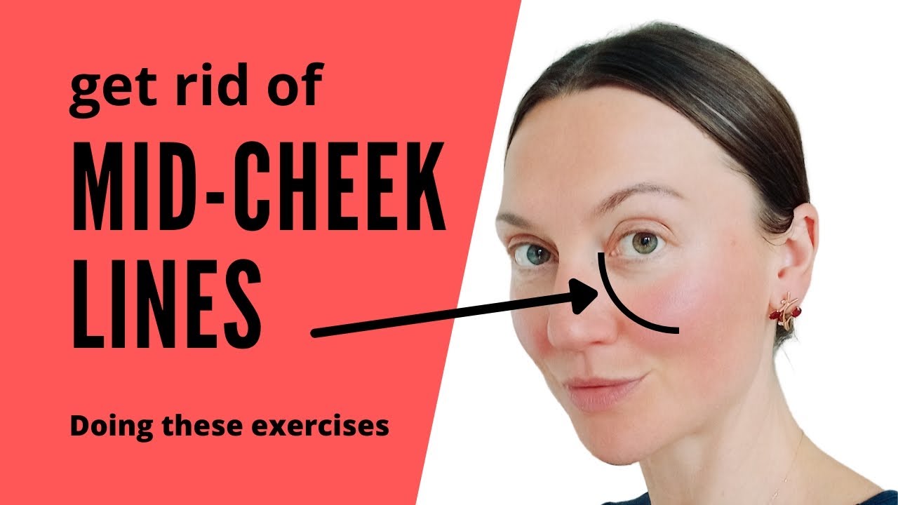 Mid-cheek lines. Face Yoga exercises. Reasons & solution to reduce and ...