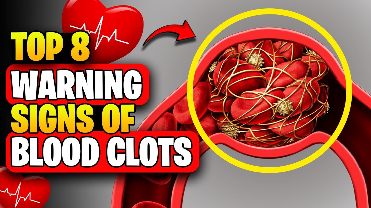 Top 8 Warning Signs Of Blood Clots What You Need to Know - Motivizee ...