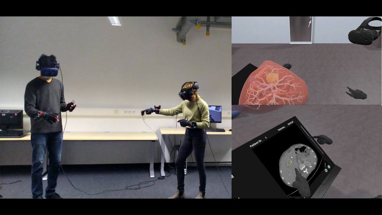 Collaborative VR for Liver Surgery Planning using Wearable Data Gloves ...