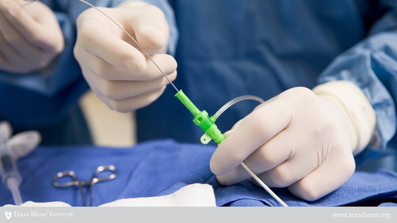 RADIAL APPROACH | CATH LAB - YouTube