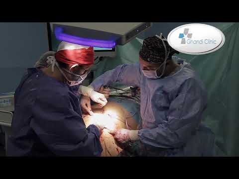 CHIRURGIE DE L’OBÉSITÉ À LA CLINIQUE GHANDI PAR DR RICHARD ABITTAN ...